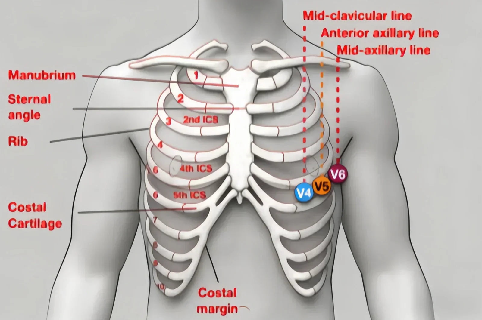 3 Lead ECG Placement: Fast, Clean, Step-by-Step | MedLinket