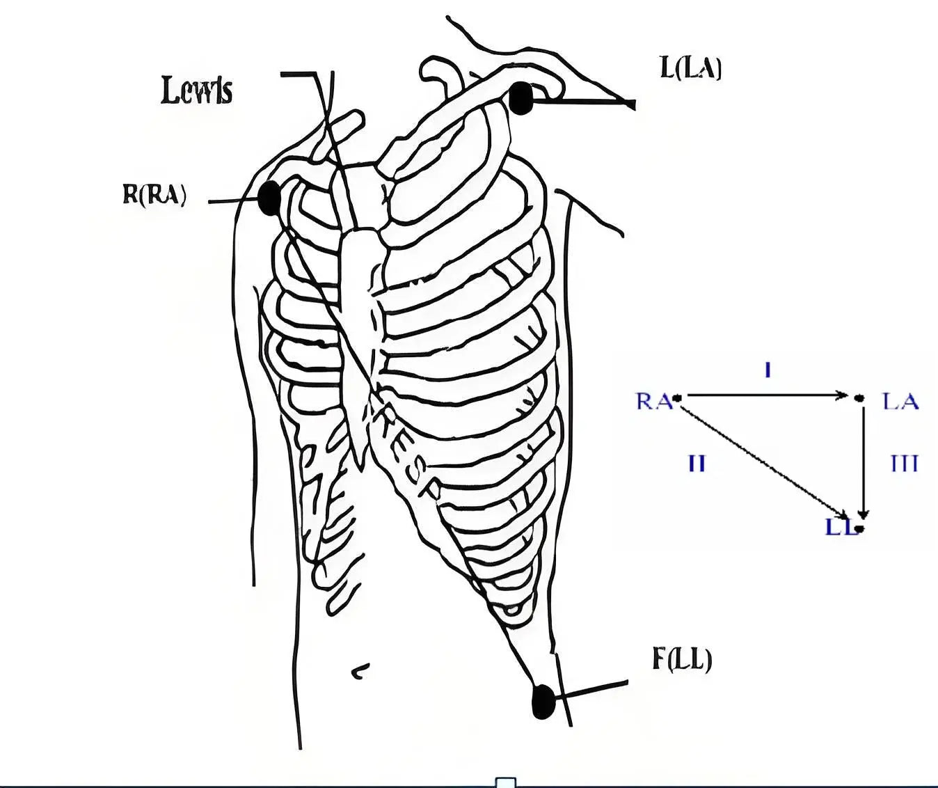 Master 3-Lead, 5-Lead & 12-Lead ECG Placement—Electrode Map Inside!