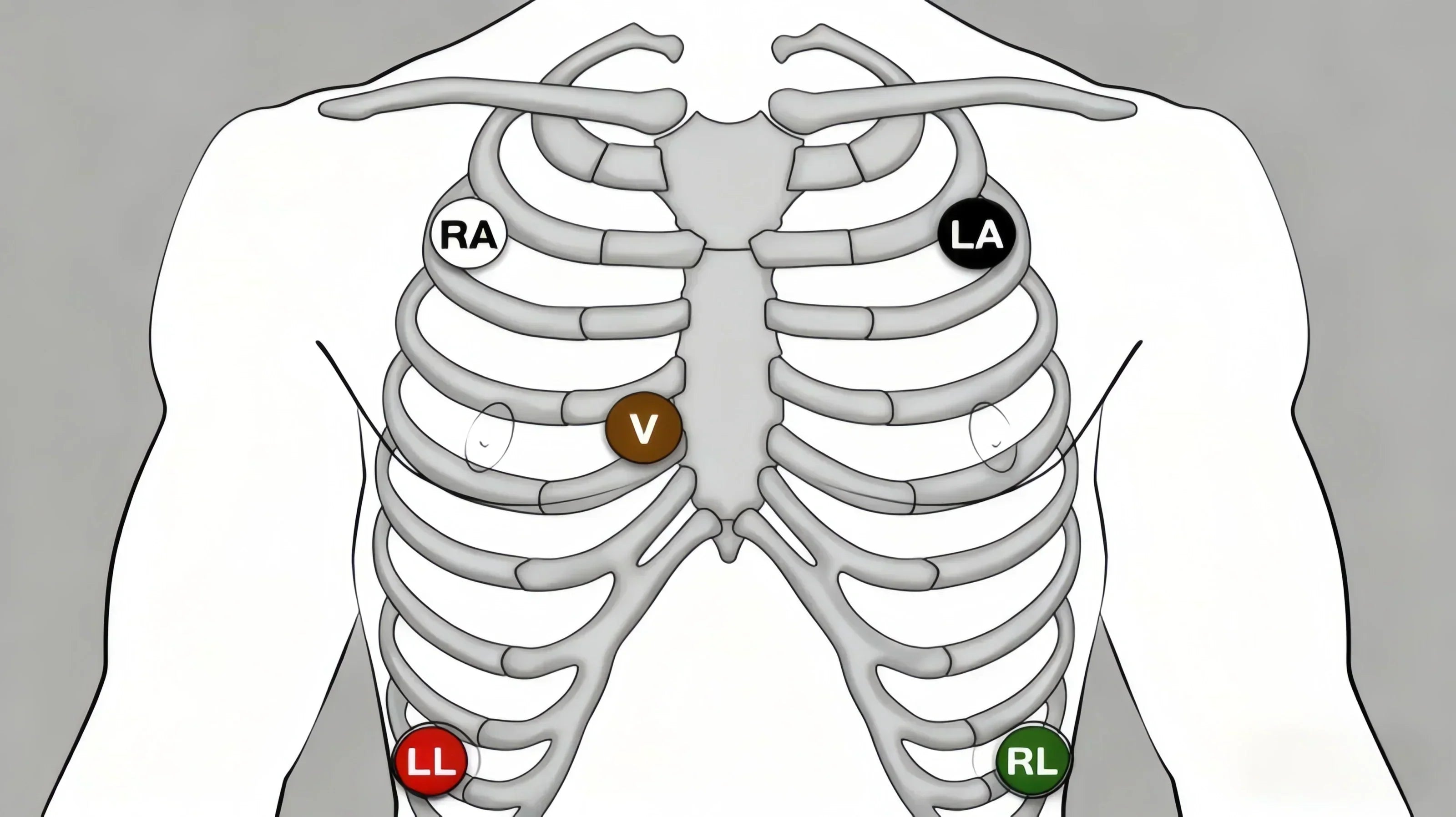 5 Lead ECG Placement: Colors, Mnemonics & Steps | Medlinket